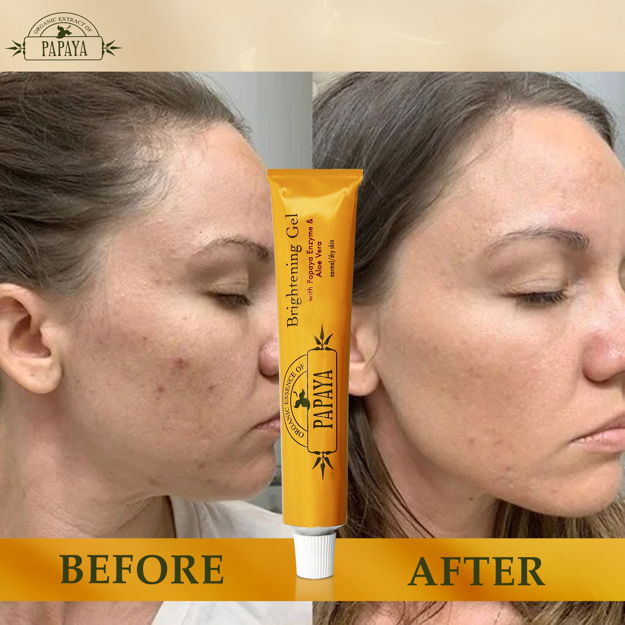 Organic Extract Of Papaya Brightening Gel 30g / 1 fl oz – Mitchell ...
